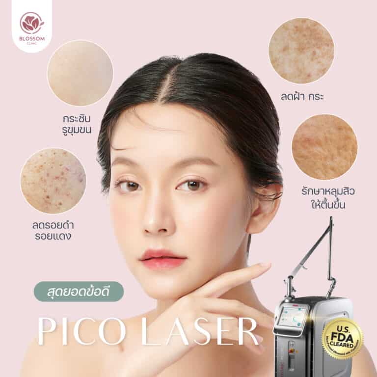 Pico Laser คืออะไร ทำไมถึงยอดนิยม? ลดกระ ฝ้า ที่ blossomclinic
